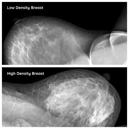 Breast Health • Dr. Steven Quay, MD, PHD